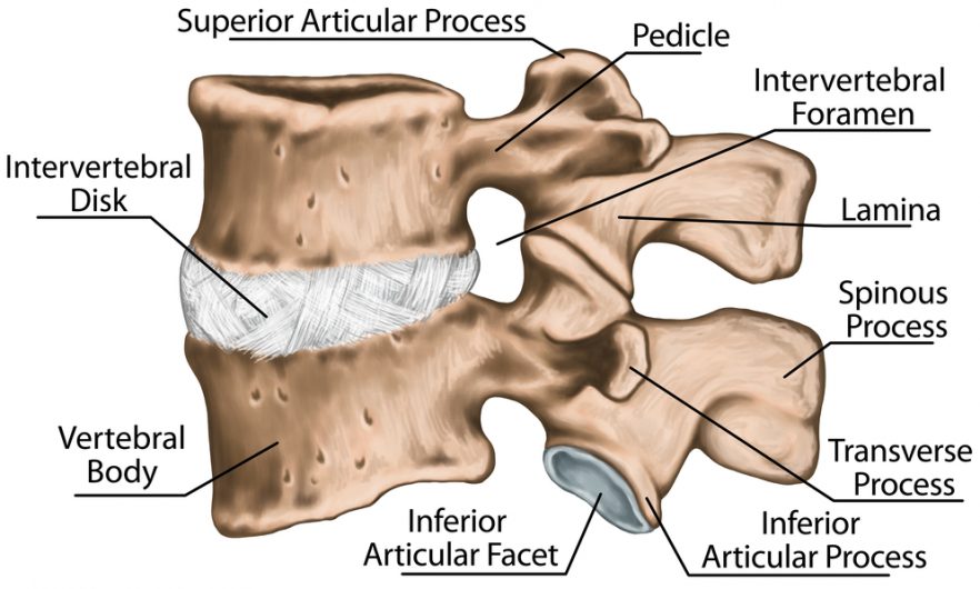 A patient's simple understanding of sciatica, radicular pain and ...